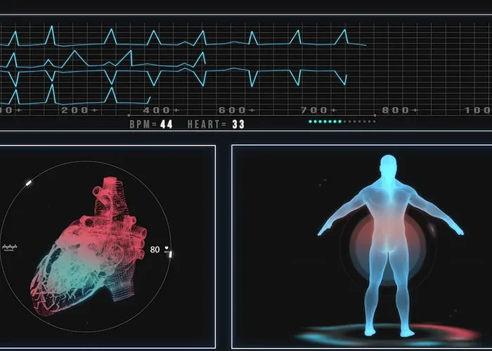 Coronary Angiogram: Procedure, Recovery, and Expert Care | Gleneagles ...