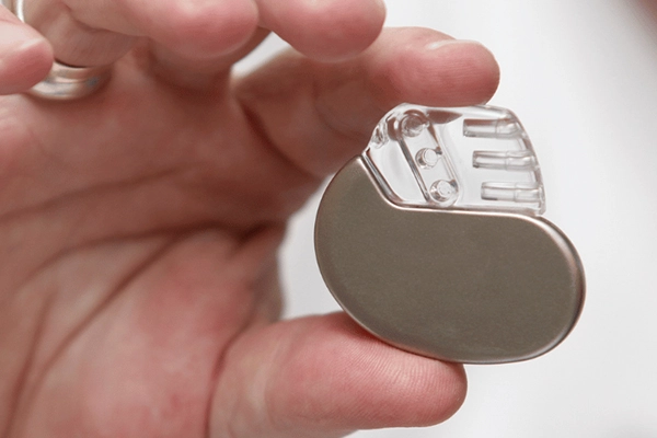 What to Expect with Pacemaker | Gleneagles Hospitals