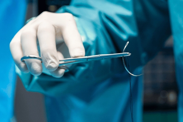 When is CABG Surgery Necessary | Gleneagles Hospitals